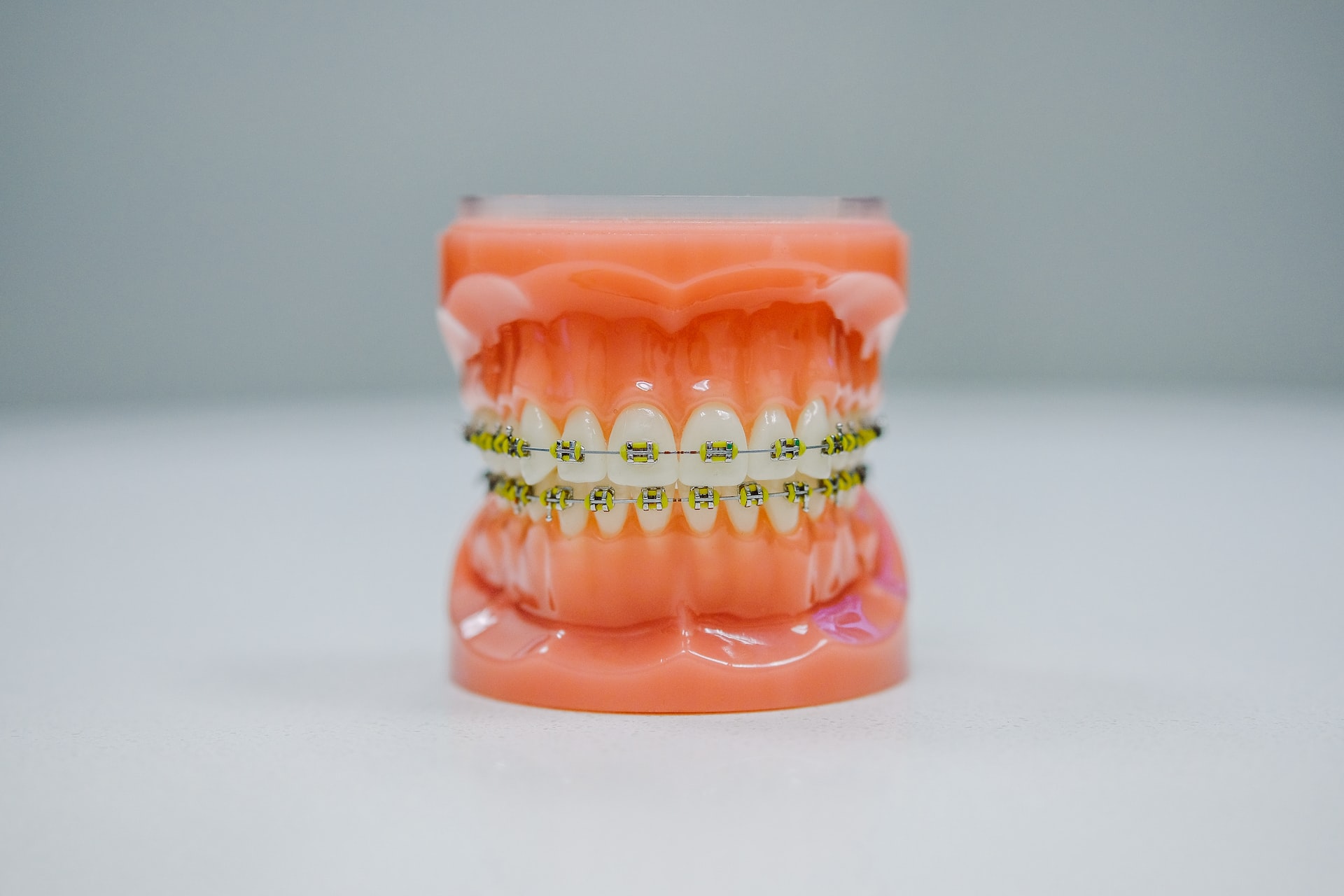 The Stages of Dental Braces Treatment: What to Expect