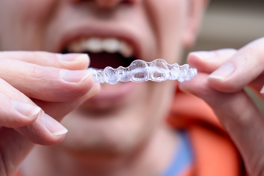 Invisalign AI Technology: Game-Changing Precision in Orthodontics